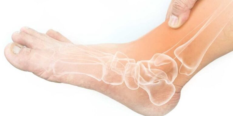 13 Most Common Golf Injuries (Don't Ignore No. 1&2) & How to Stay Safe ...